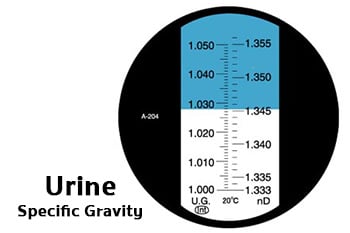 ค่าความถ่วงจำเพาะของปัสสาวะ (Urine specific gravity หรือ Sp.Gr.)