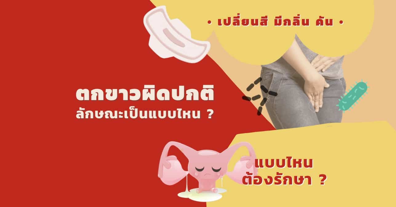 ตกขาว (Leukorrhea) อาการ สาเหตุ การรักษา ฯลฯ